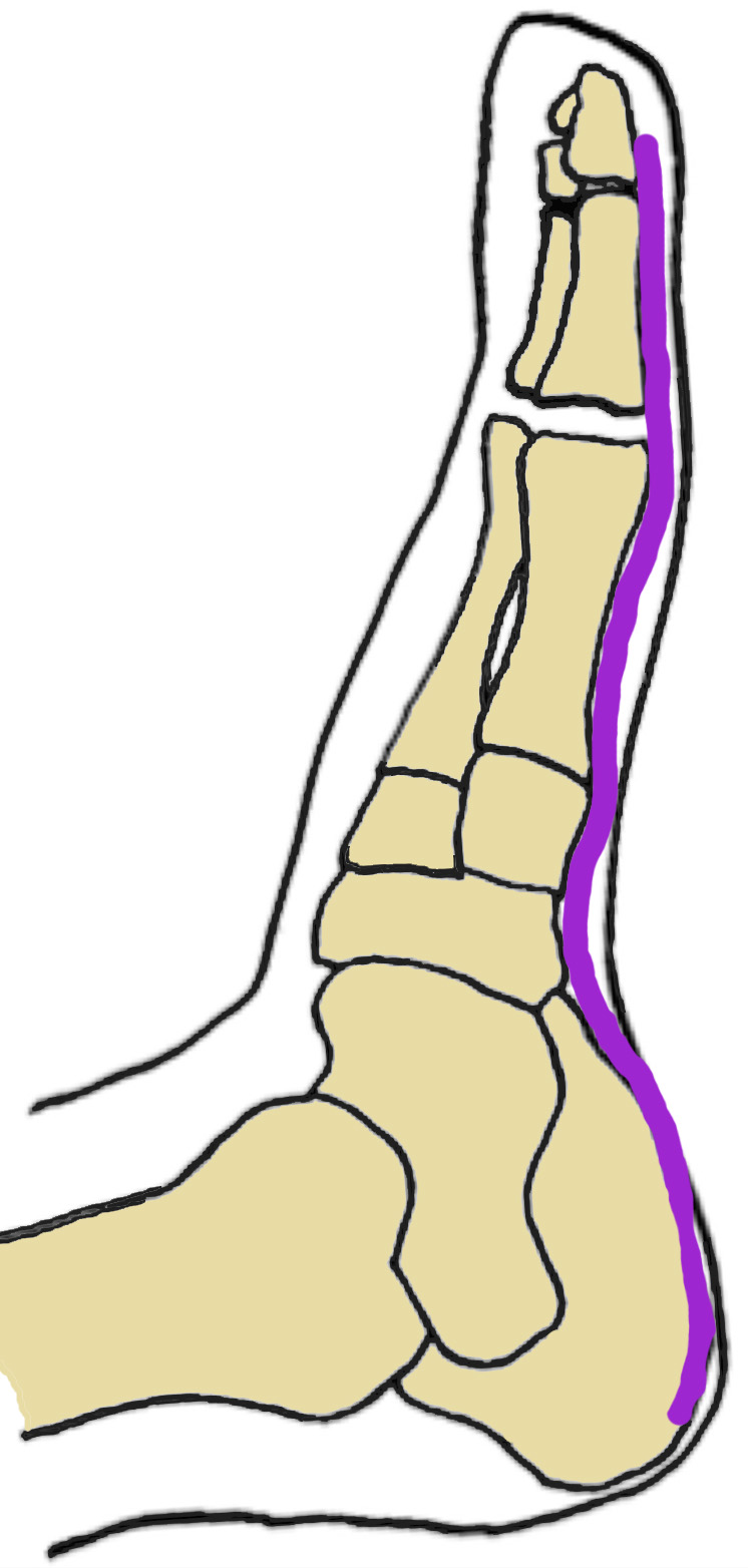 Where are the spinal reflexes located on the feet? « Put Your Best Feet ...