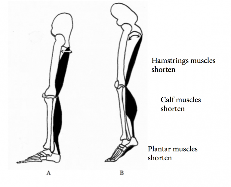 The calf muscle and the heart « Put Your Best Feet Forward