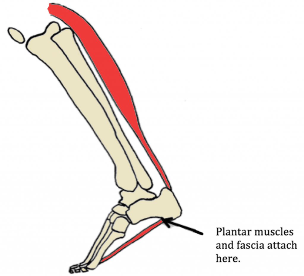 Plantar fasciitis simplified « Put Your Best Feet Forward