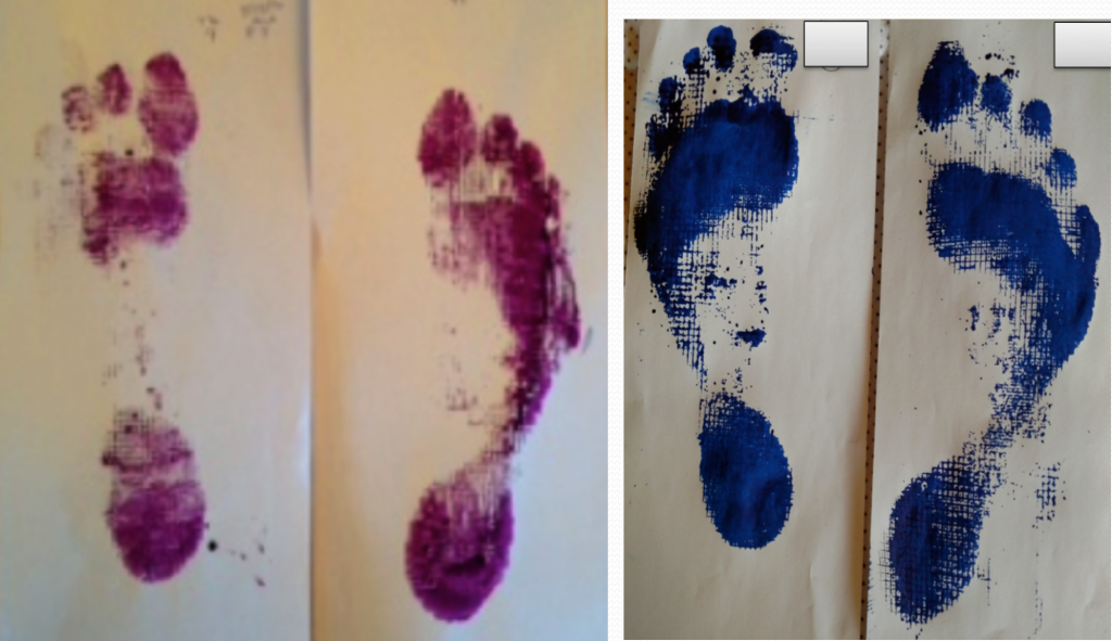 Using an Ink Press to assess for foot problems « Put Your Best Feet Forward