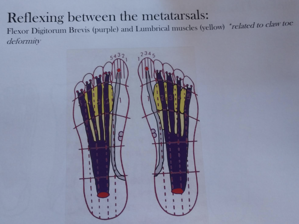 Understanding Hammer-Toes and How to Unbind Them « Put Your Best Feet ...